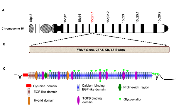 Overview of Marfan Syndrome: knowns and unknowns | Matkar | Journal of ...